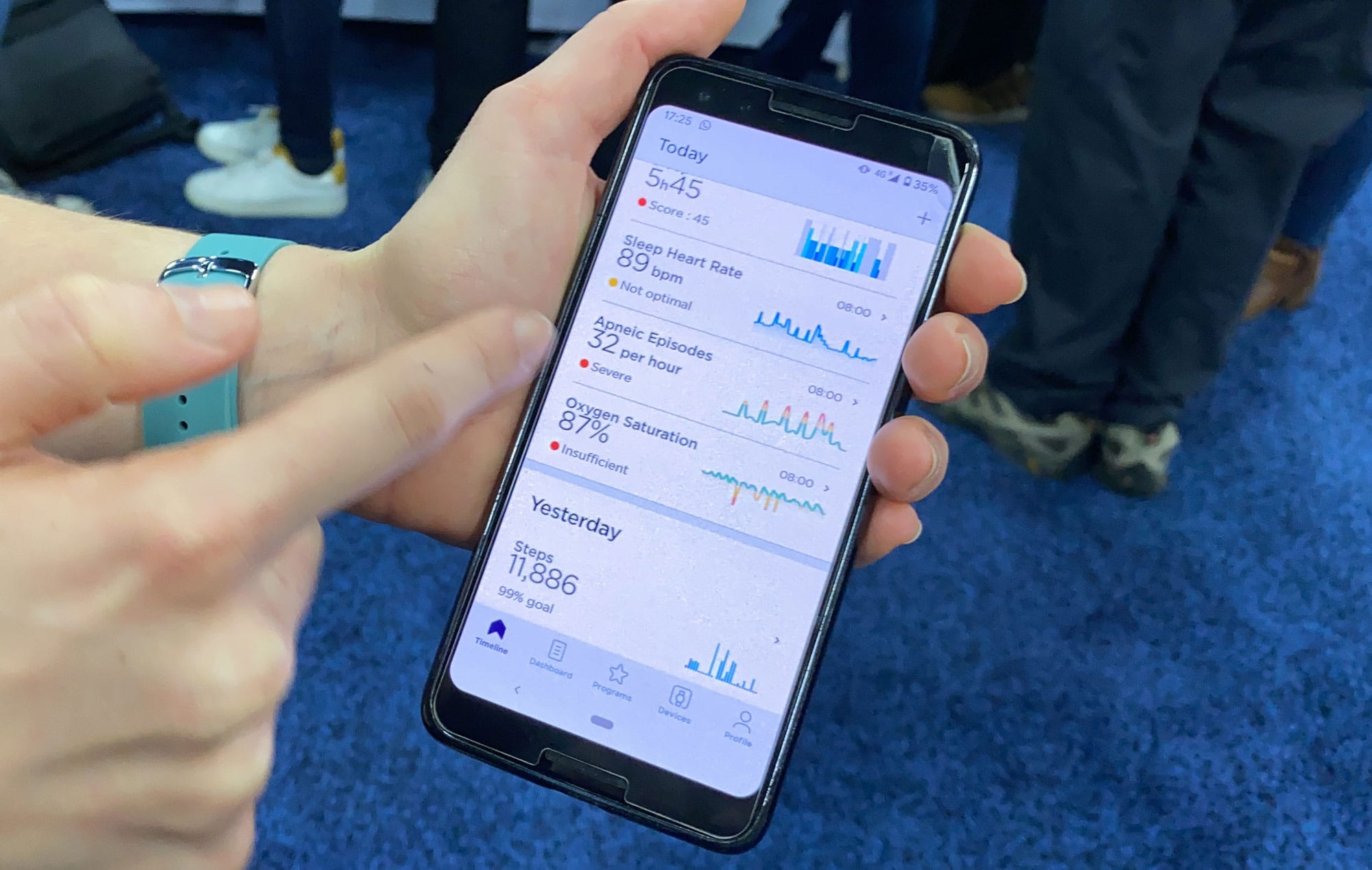 Withings launches smartwatch for tracking afib, apnoea – Pickr